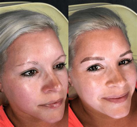 Microblading Healing Process A Complete Guide