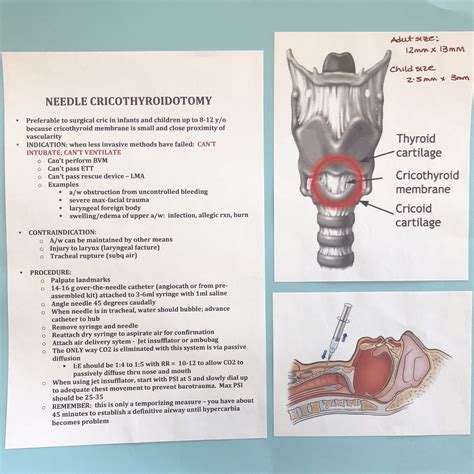 Pediatric Cricothyroid Membrane