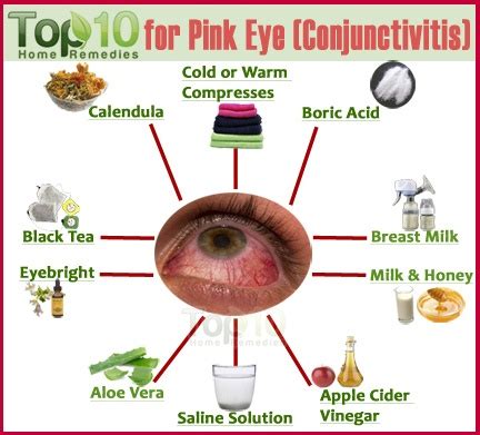 Home Remedies For Pink Eye Conjunctivitis Top 10 Home Remedies