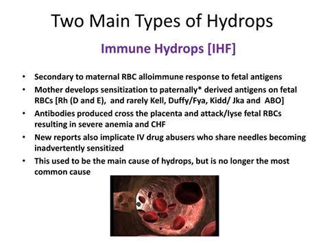 Ppt A New Look At Hydrops Fetalis By Laura Klee Rnc Msn Powerpoint