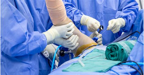 Rotator Cuff Surgery Purpose Preparation Procedure And Recovery