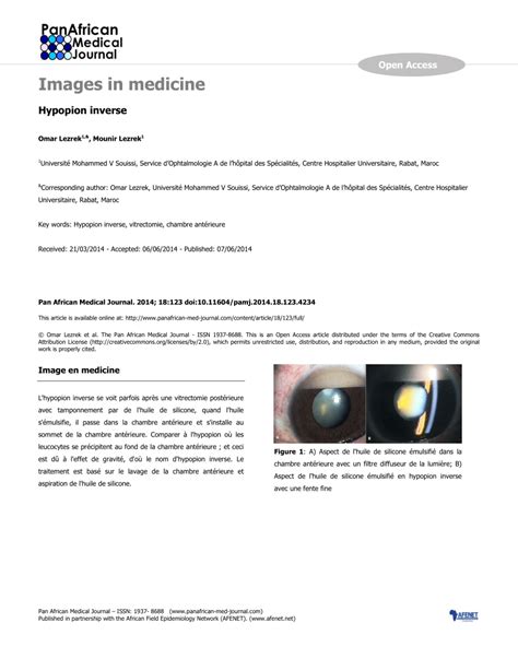 Pdf Inverse Hypopyon