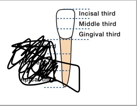 Terminology Of Tooth Morphology And Anatomical Descriptors Flashcards
