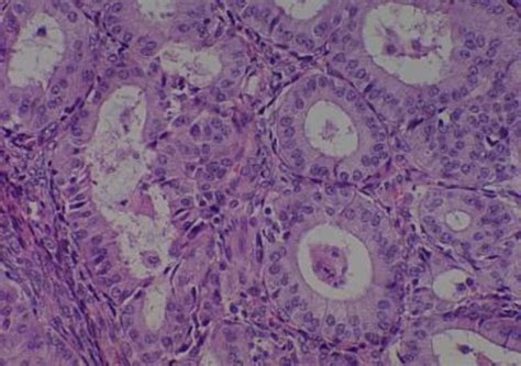 Novus Biologicals™ Human Ovary Tissue Microarray Cancer Slide Human