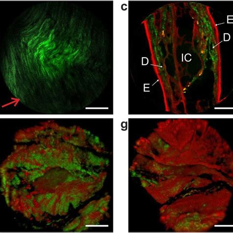 Fixed Tissue Sample At Elmer May Blog