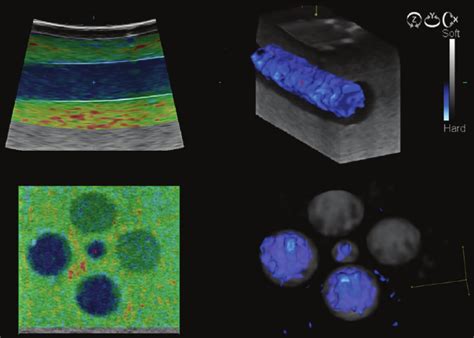 Three Dimensional Elastography Of Phantom Objectives The Phantom