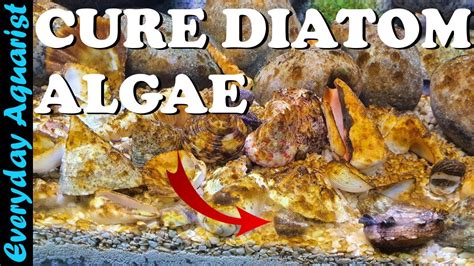 Brown Diatom Algae Saltwater