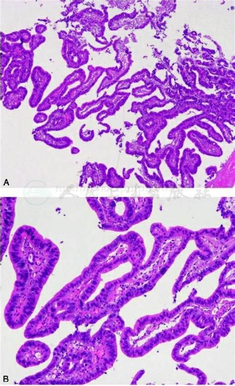 疾病详情 疾病 人卫临床助手 人民卫生出版社