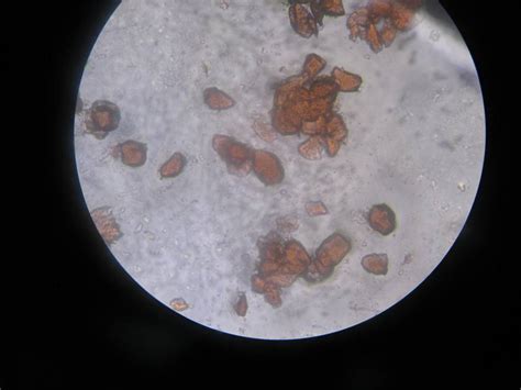 El Ser Vivo Mas Pequeño Del Mundo Junio 2012