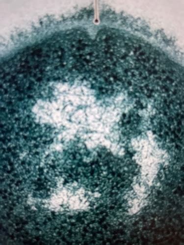 Streptococcus Pneumonia Flashcards Quizlet