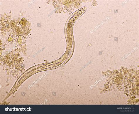 Strongyloides Stercoralis Threadworm Human Stool Analyze Foto Stock