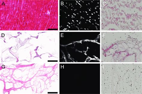 Histological Analysis Of Human Heart Decellularization Human