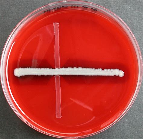 Camp Test Reversarcanobacterium Haemolyticum