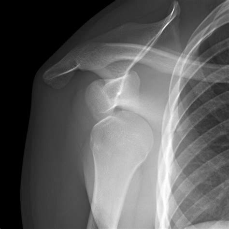 Peds Radiographs Case 18