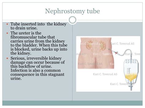 Ppt Casts Drains And Dressings Powerpoint Presentation Free Download Id 2254751