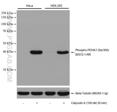 Phospho Pdh E1 Alpha Ser300 Antibody 80572 1 Rr Proteintech