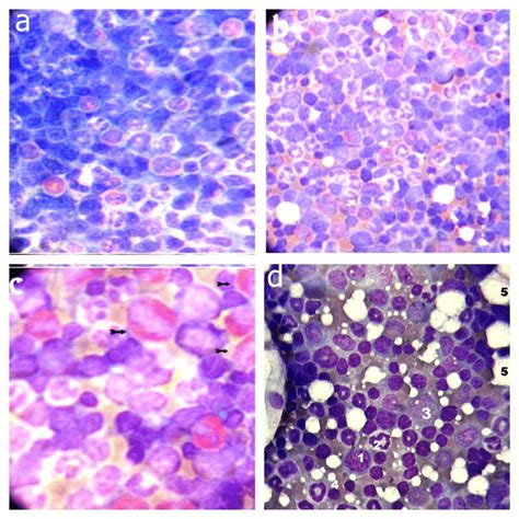 A Bone Marrow Of Control Group Showing Normal Cellularity Giemsa