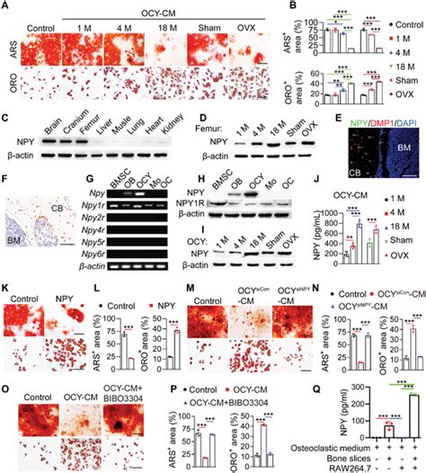 Osteocytes Secrete Excess Npy During Skeletal Aging And Osteoporosis To Download Scientific