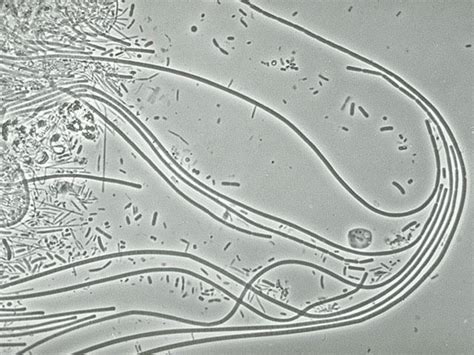 Thiothrix Alchetron The Free Social Encyclopedia