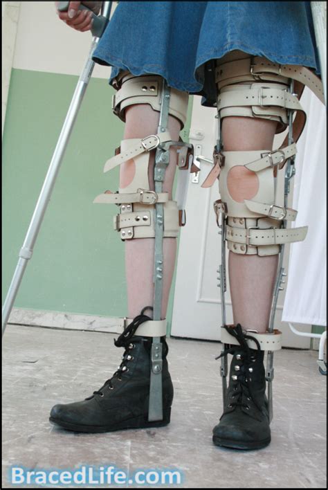 Hailey Leg Braces 4 By Medicbrace On Deviantart
