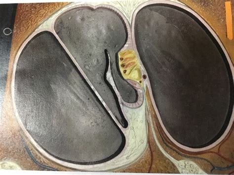 Flat Cochlea Model Diagram Quizlet