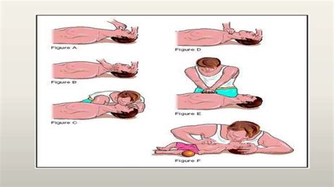 Cardio Pulmonary Resuscitation Pptx