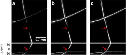 13 Rsom Imaging Of A 30 µm Suture Cross Phantom Top And Bottom Panels Download Scientific