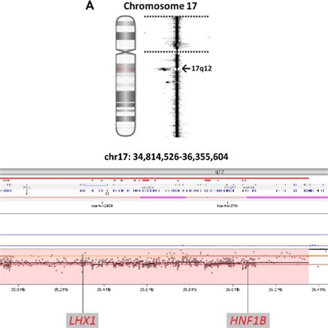Pdf Detection Of Recurrent Transmission Of 17q12 Microdeletion By Array Comparative Genomic