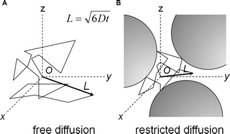 Mr Diffusion Imaging In Ischemic Stroke Radiology Key