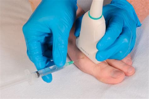Performing An Ultrasound Guided First Mtp Joint Injection Sports