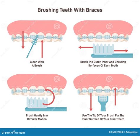 Brushing Teeth With Braces System Oral Care With Special Brush Stock