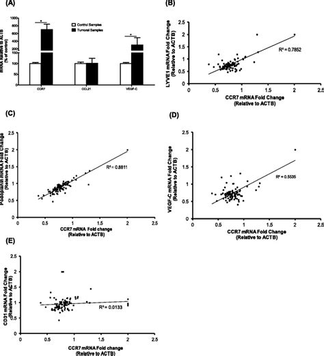 The Role Of Ccl21ccr7 Chemokine Axis In Breast Cancer Induced