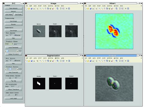 Dic Bacterial Cells Image Analysis Toolbox Screen Shots Of The Dic