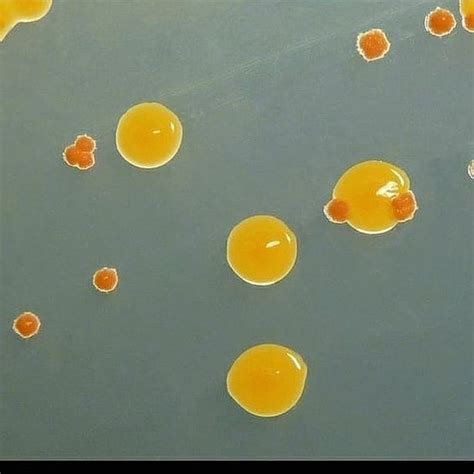 Microscopy Photos Chryseobacterium Indologenes Yellow And An