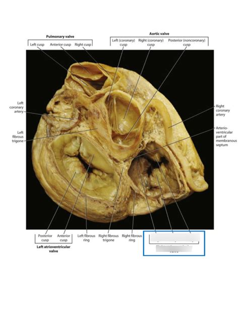 71 Diagram Quizlet 71 Diagram Quizlet