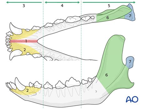 Mandible Fracture Classification