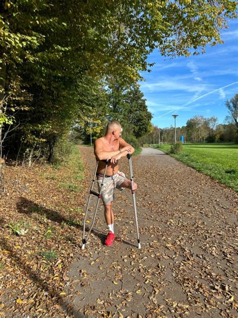 Amputeeboy On Tumblr