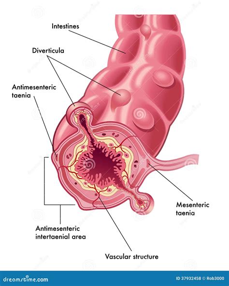 Diverticula Stock Illustration Illustration Of Diverticula 37932458
