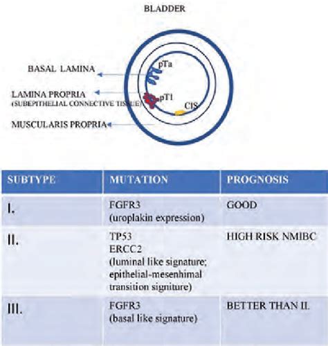 Nmibc Molecular Subgroups Fgfr3 Fibroblast Growth Factor Receptor 3 Download Scientific