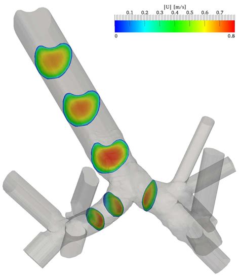 Two Dimensional Colour Encoded Distribution Of The Velocity Magnitude