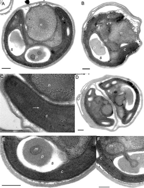 Prasinoderma Coloniale Rcc 137 Transmission Electron Micrographs Of