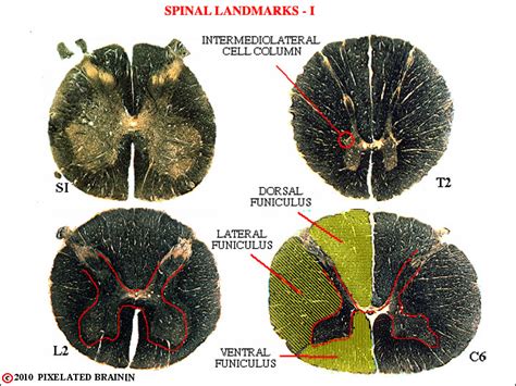 Lateral Funiculus