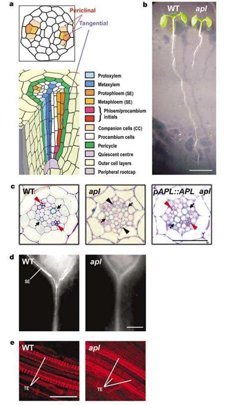 Ap Has An Altered Vascular Pattern A Schematic Of