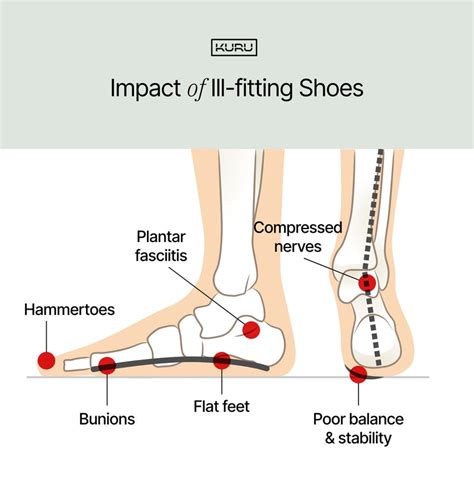 42 Shocking Facts About Shoes Kuru Footwear