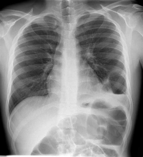 Pin On Excalibur Healthcares Imaging And Teleradiology Pins