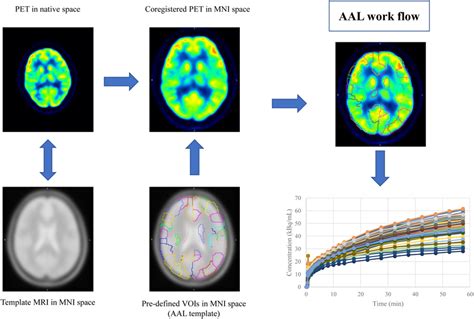 Compare The Ipsilateral And Contralateral Regions Between Patients