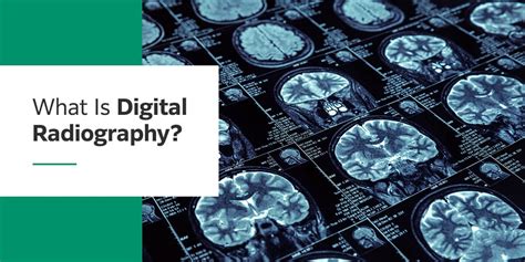 What Is Digital Radiography Ndt Radiography Guide