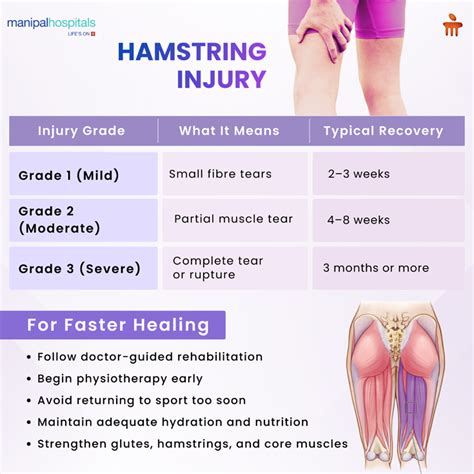 Grades Of Hamstring Pulls 857x589