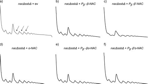 Expression Levels Of β Nac Are Important For Complementation Of Download Scientific Diagram
