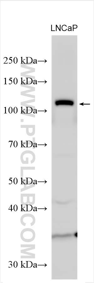 Prkd1 Antibody 20714 1 Ap Proteintech 武汉三鹰生物技术有限公司